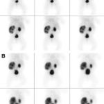 Nuclear Medicine Renal Imaging - Renal Fellow Network
