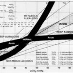 Mnemonic for NON-Anion Gap Metabolic Acidosis - Renal Fellow Network