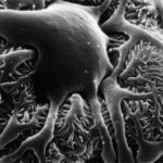 podocyte biology Archives - Renal Fellow Network