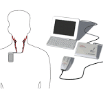 Rheos Implantable Blood Pressure Device - Renal Fellow Network