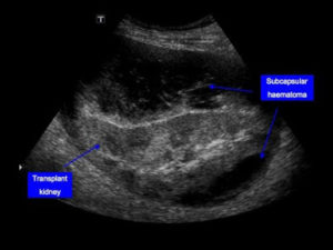 Nephrology Boards - Renal Fellow Network