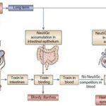 Typical HUS: beyond shiga - Renal Fellow Network