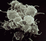 Uremic platelets? - Renal Fellow Network