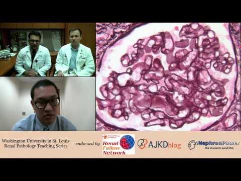 Web Episode #005 - Renal Pathology Teaching Series - Renal Fellow Network