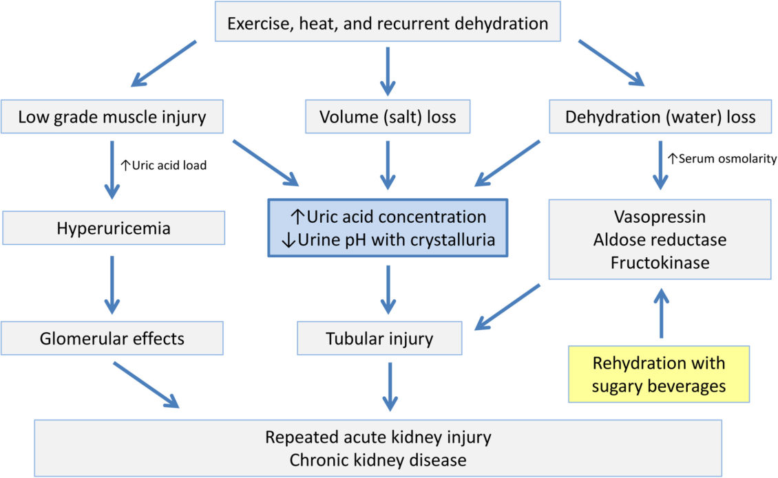 “La Creatinina”-A Modern Epidemic of Kidney Disease - Renal Fellow Network