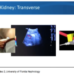 Point-of-Care Ultrasound (POCUS) Videos - Renal Fellow Network