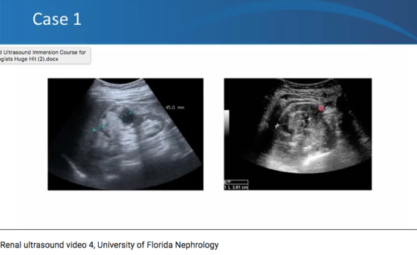 Point-of-Care Ultrasound (POCUS) Videos - Renal Fellow Network