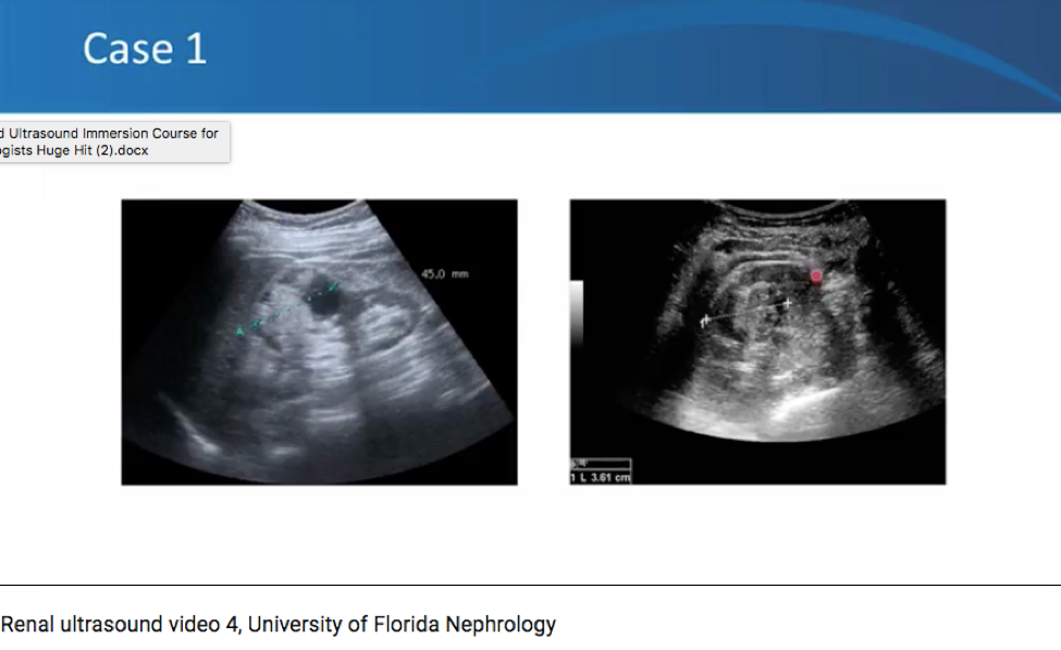 Point-of-Care Ultrasound (POCUS) Videos - Renal Fellow Network