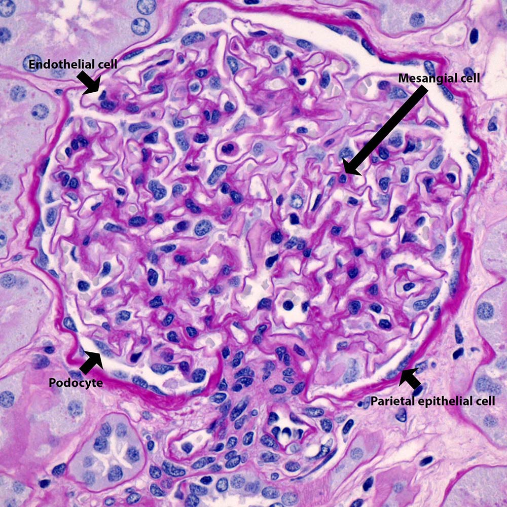 Glomerular Basement Membrane Histology