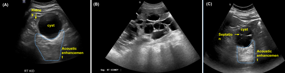 POCUS Gallery - Renal Fellow Network