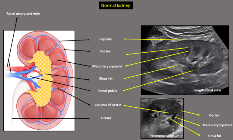 POCUS Gallery - Renal Fellow Network