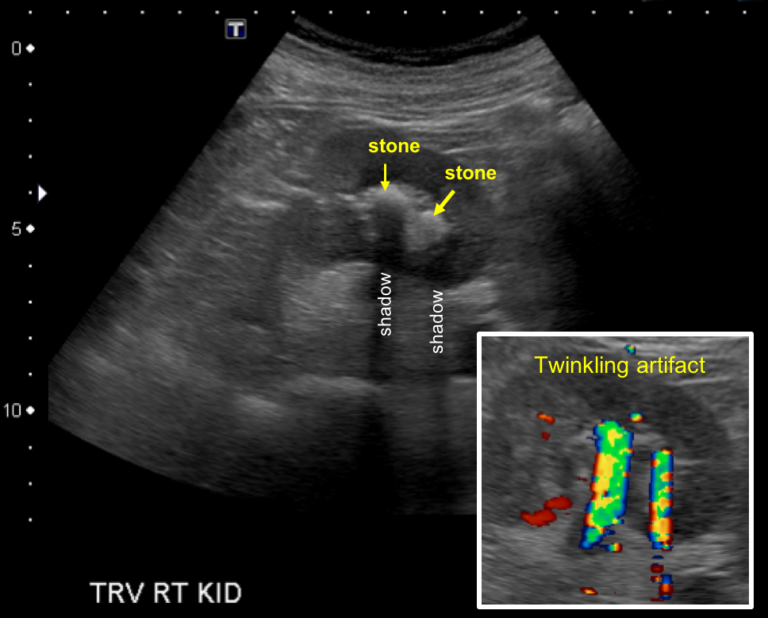 POCUS Gallery - Renal Fellow Network