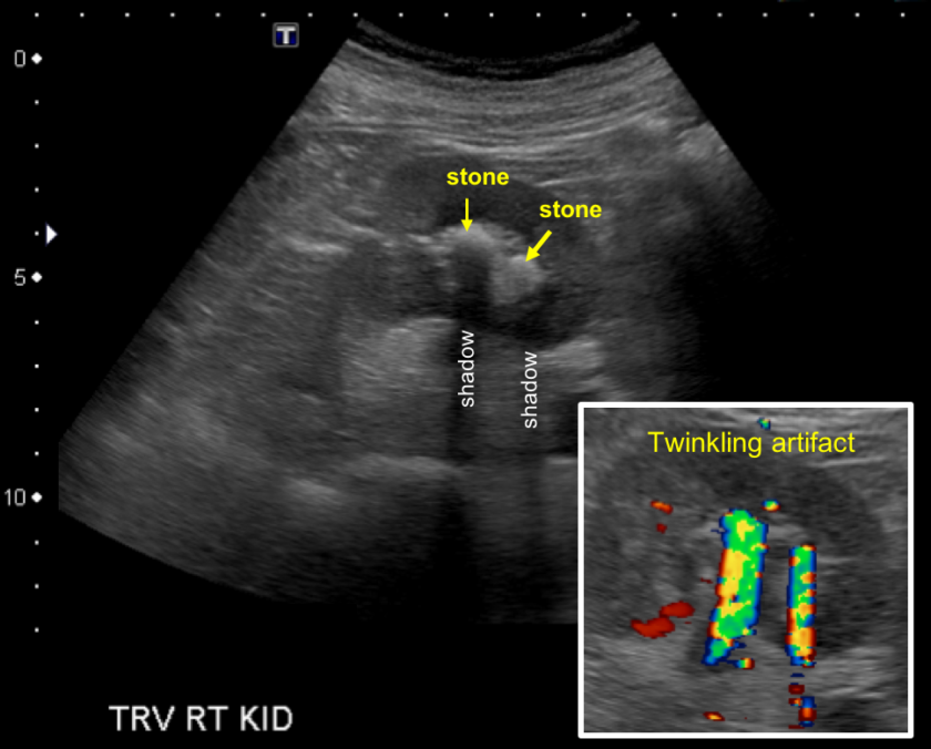 POCUS Gallery - Renal Fellow Network