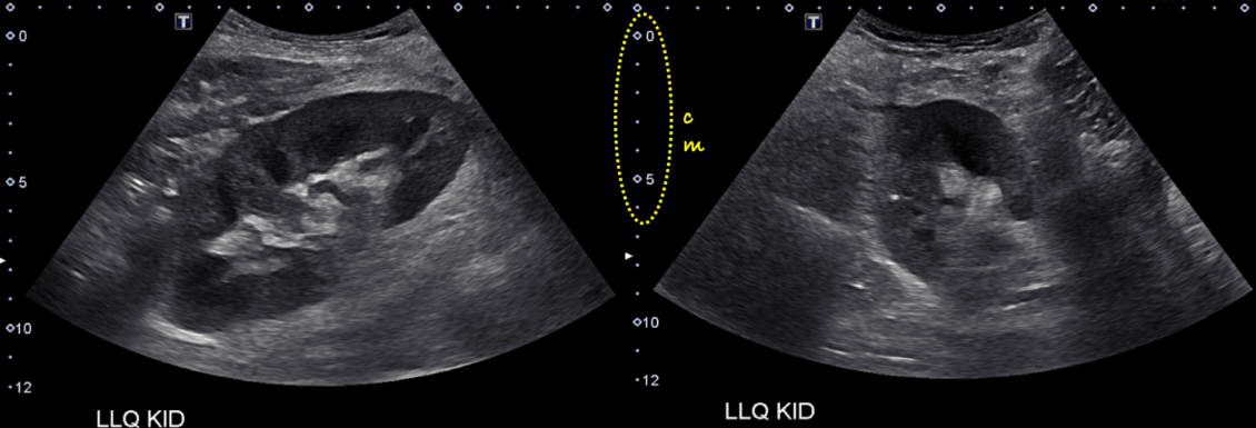POCUS Gallery - Renal Fellow Network