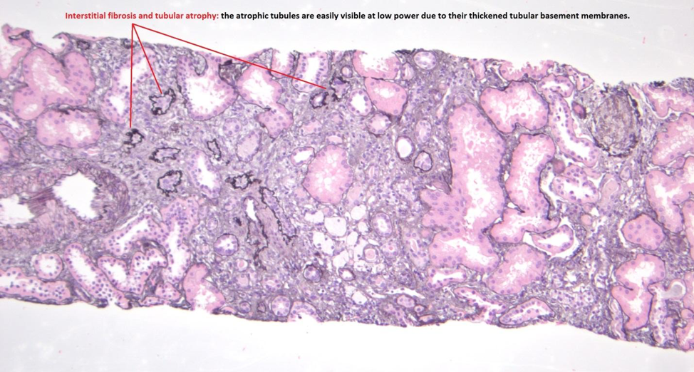 Renal Medulla Histology