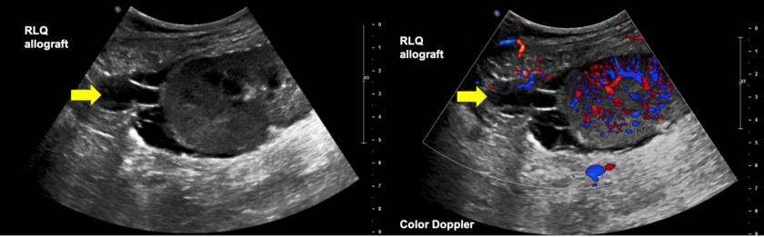 POCUS Gallery - Renal Fellow Network