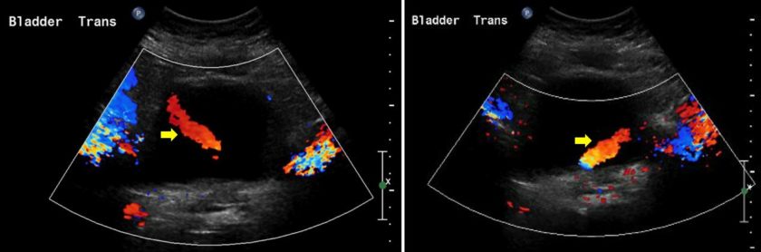 POCUS Gallery - Renal Fellow Network