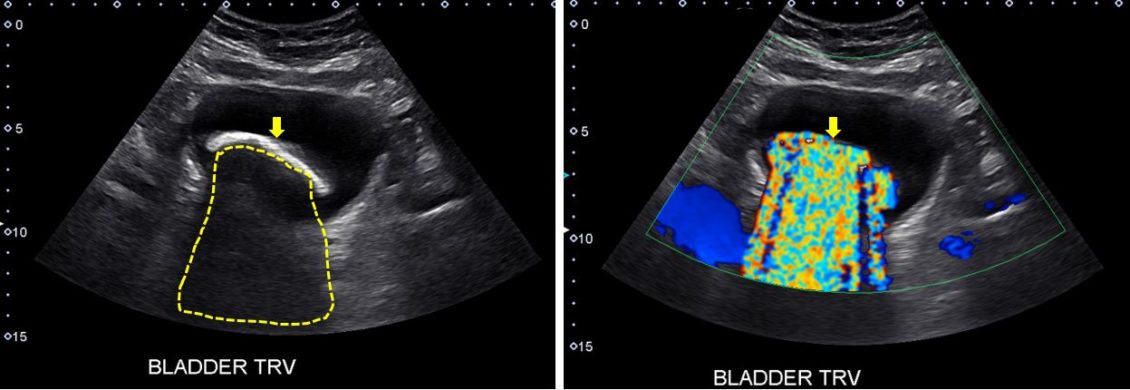 POCUS Gallery - Renal Fellow Network