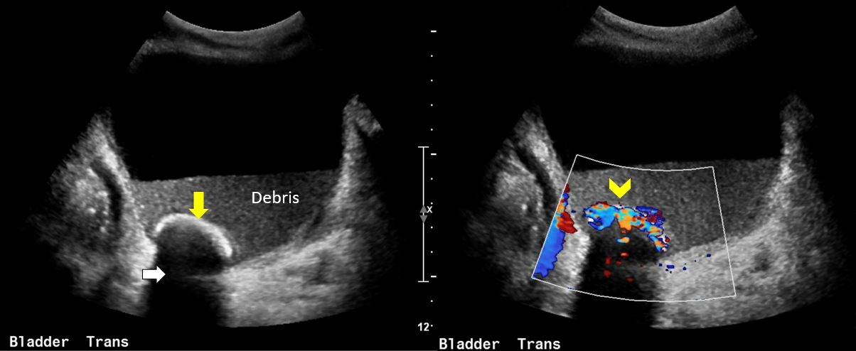POCUS Gallery - Renal Fellow Network