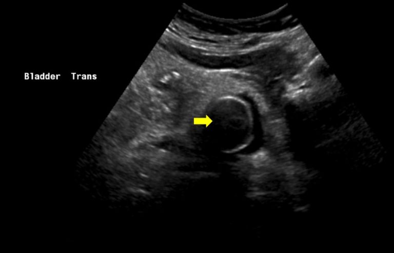 POCUS Gallery - Renal Fellow Network