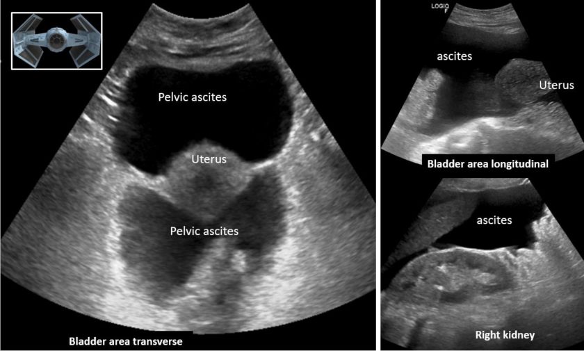 POCUS Gallery - Renal Fellow Network