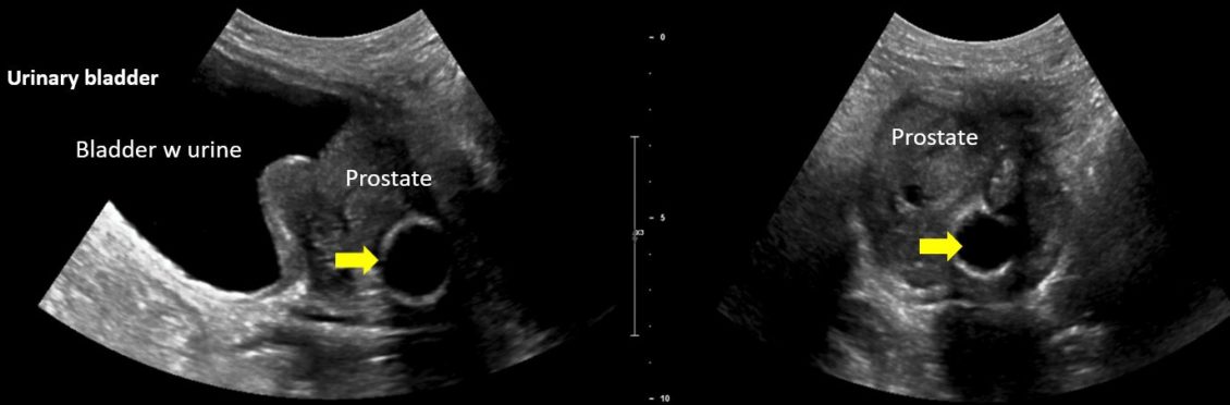 POCUS Gallery - Renal Fellow Network