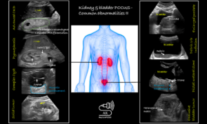 POCUS Gallery - Renal Fellow Network