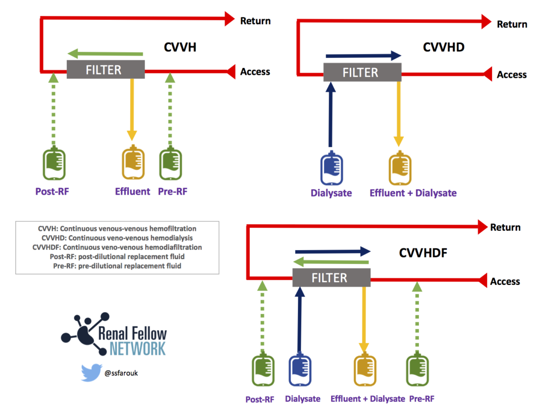 Dosing Continuous Renal Replacement Therapies (CRRT): What is Enough ...
