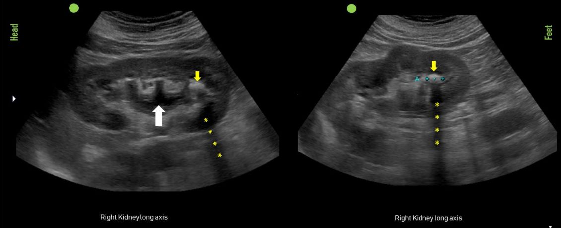 POCUS Gallery - Renal Fellow Network