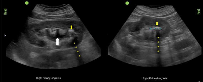 POCUS Gallery - Renal Fellow Network
