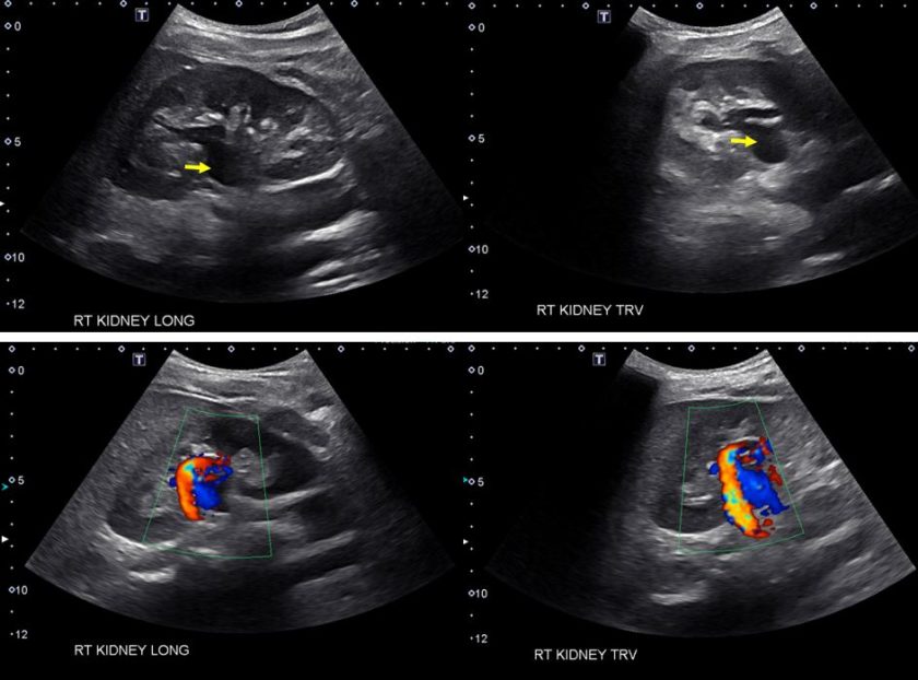 POCUS Gallery - Renal Fellow Network