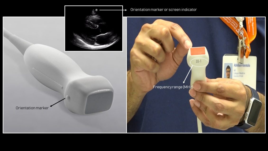 Introduction to Focused Cardiac Ultrasound: The Parasternal Long Axis ...