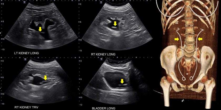 POCUS Gallery - Renal Fellow Network