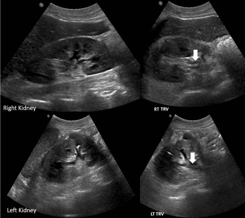 POCUS Gallery - Renal Fellow Network