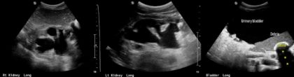 POCUS Gallery - Renal Fellow Network