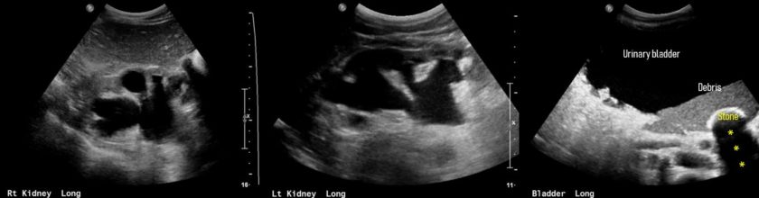 POCUS Gallery - Renal Fellow Network