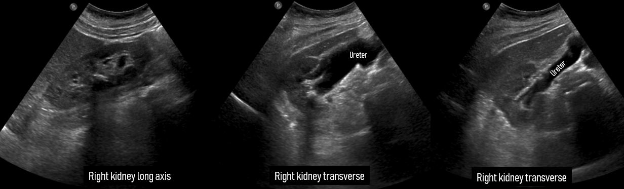 POCUS Gallery - Renal Fellow Network