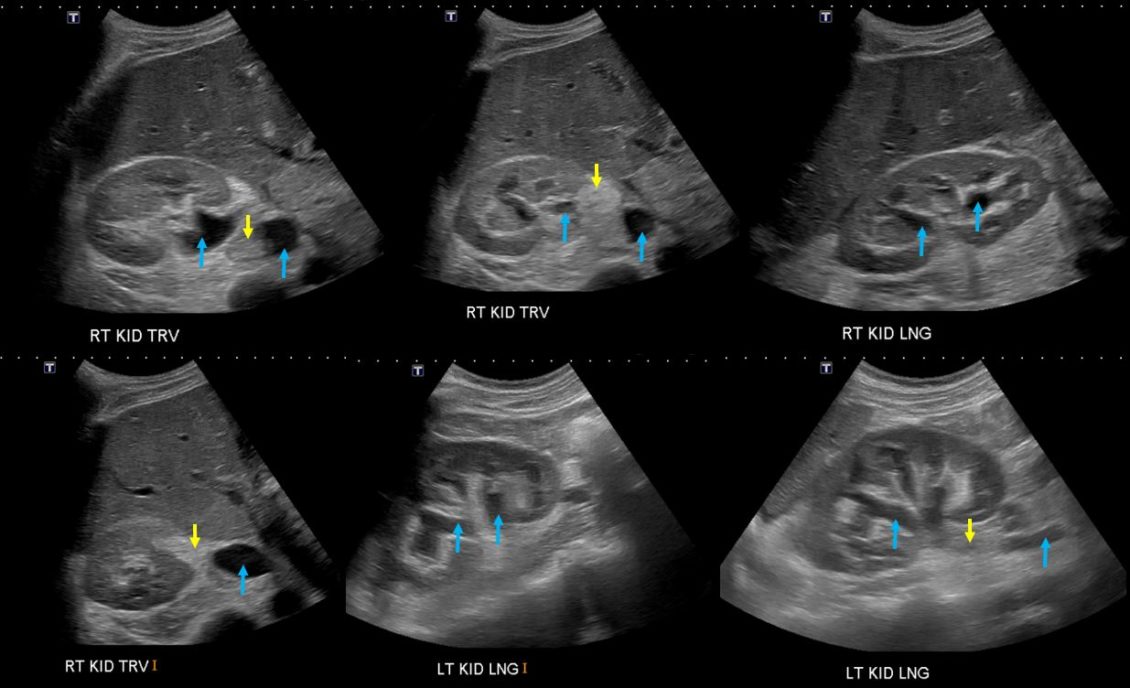 POCUS Gallery - Renal Fellow Network