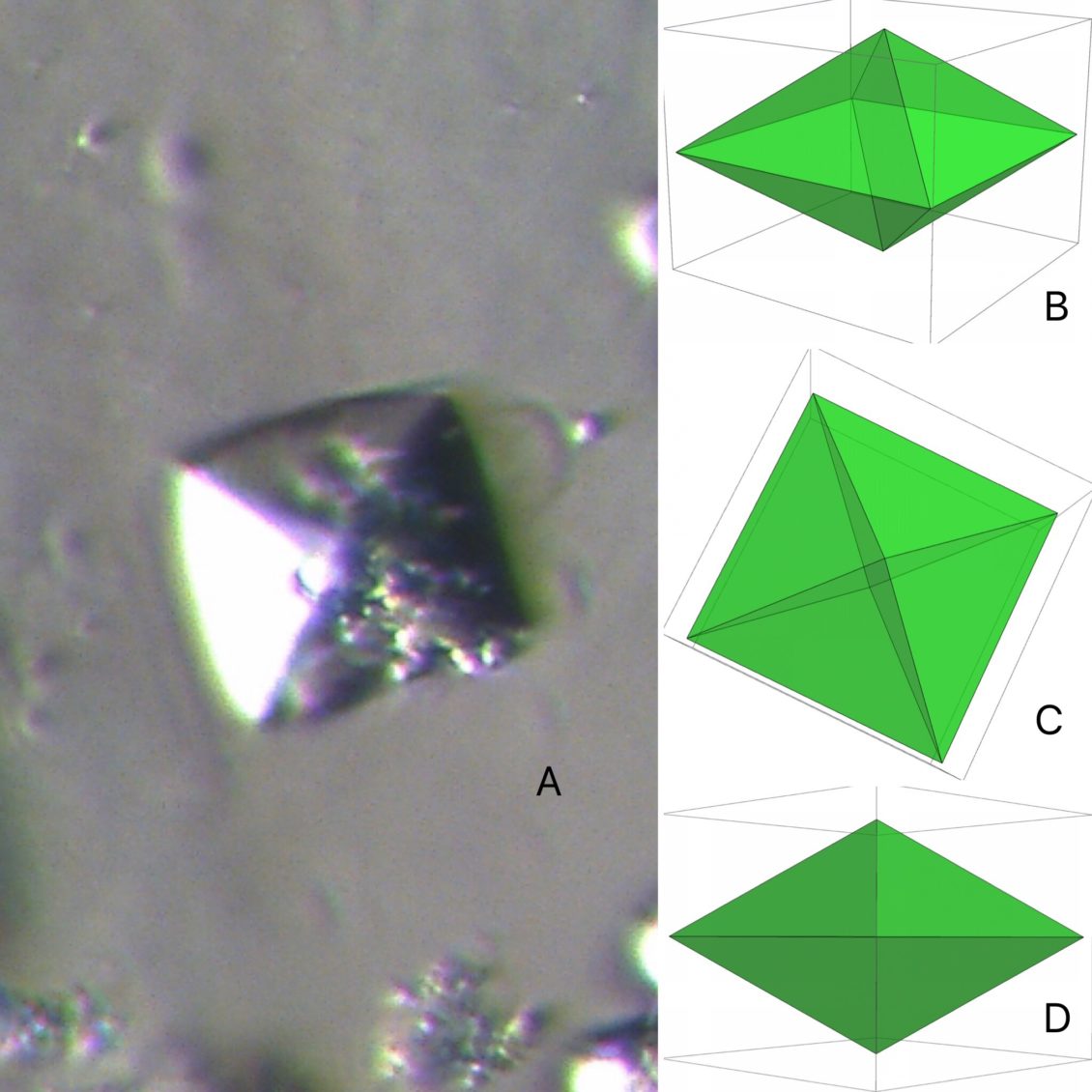 Urine Sediment of the Month: Common Crystals! - Renal Fellow Network