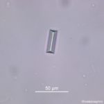 Urine Sediment of the Month: Common Crystals! - Renal Fellow Network