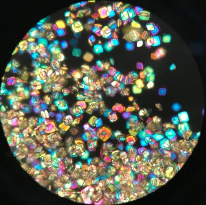 Urine Sediment of the Month: Common Crystals! - Renal Fellow Network