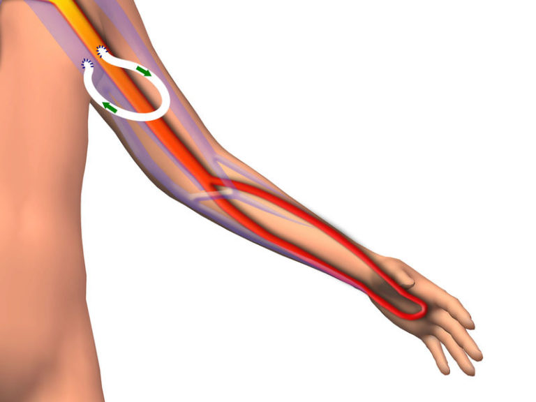 The Skeleton Key Group: Electrolyte Case #1 - Renal Fellow Network