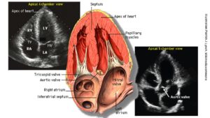Focused Cardiac Ultrasound for the Nephrologist: The apical window ...