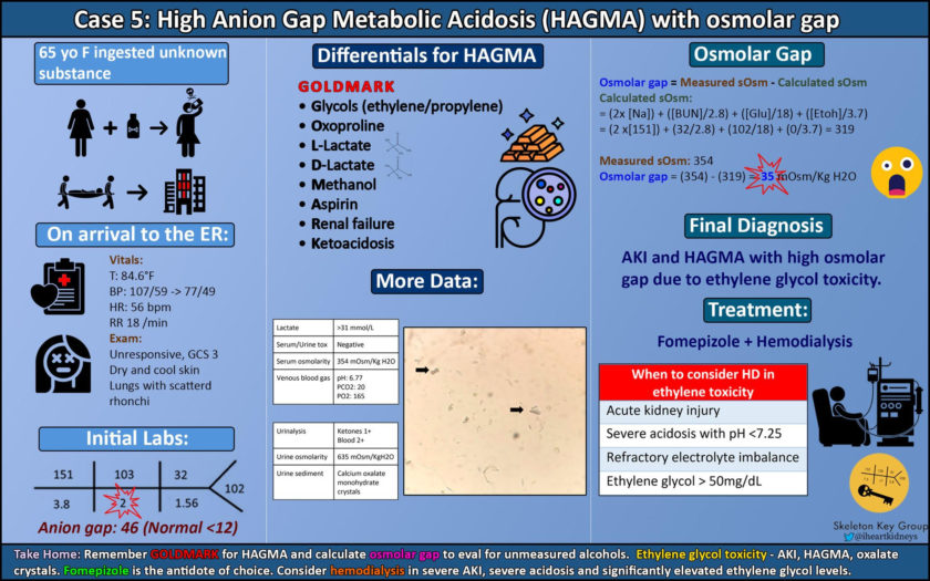 Kidney Biopsy of the Month: Atheroembolic Kidney Disease - Renal Fellow ...