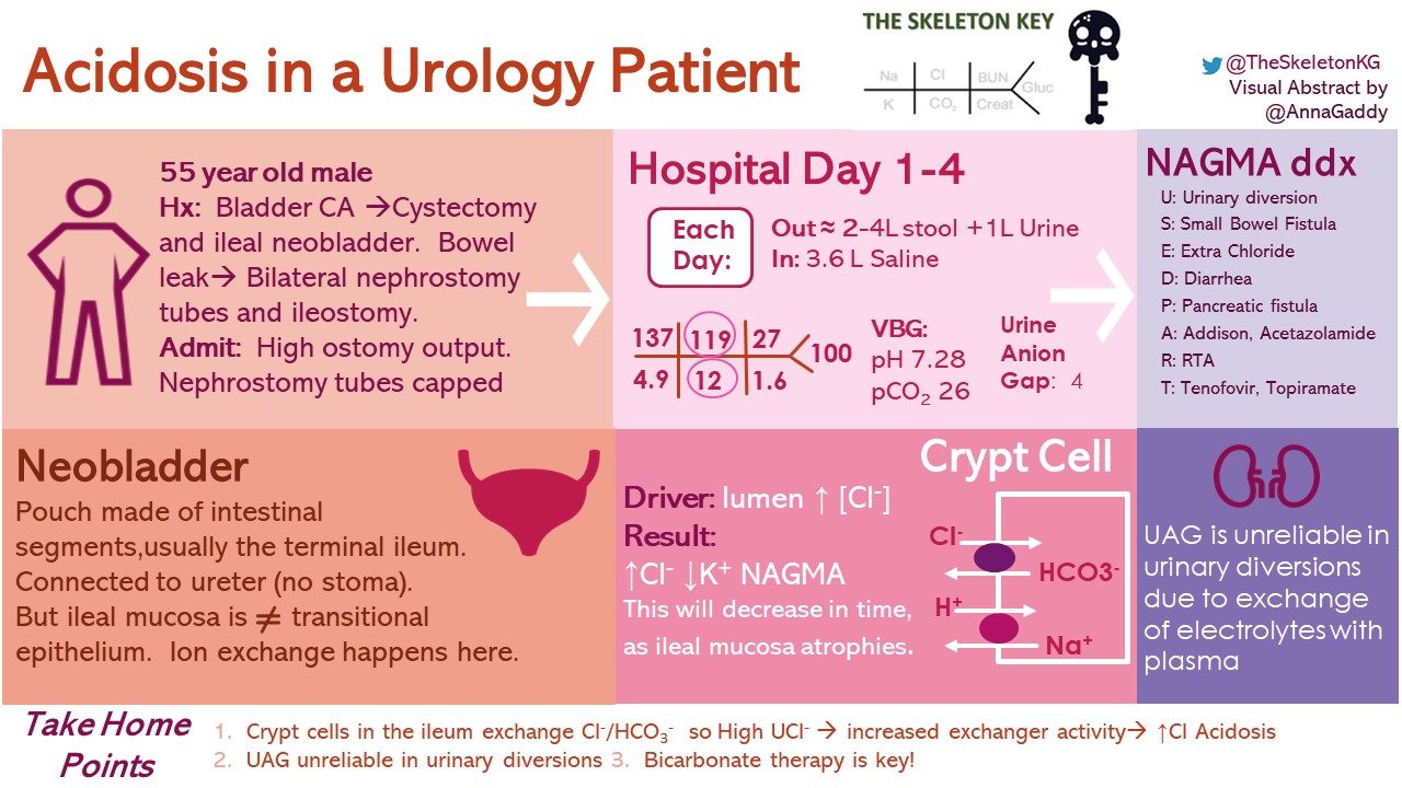 neobladder Archives - Renal Fellow Network