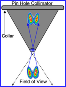 Parathyroid Imaging in Patients with Kidney Disease - Renal Fellow Network