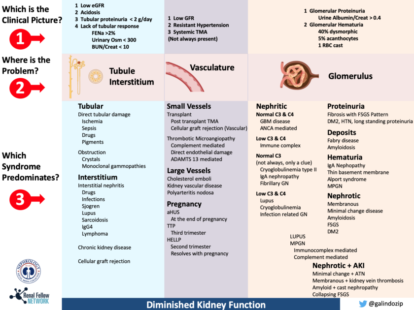 Urine Sediment of the Month: Dysmorphic Red Blood Cells, Blebs ...