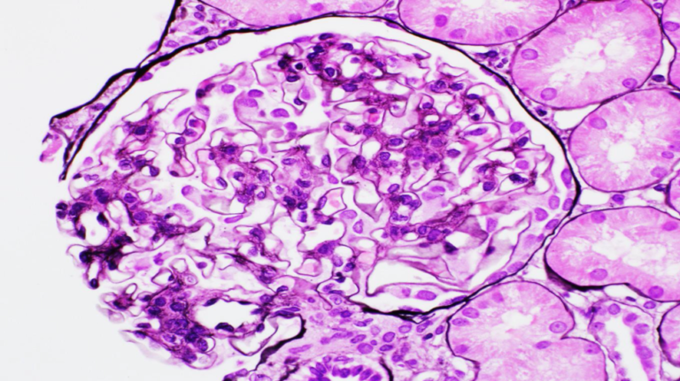 A Guide to Compartmentalize the Etiologies of Kidney Disease- The ...