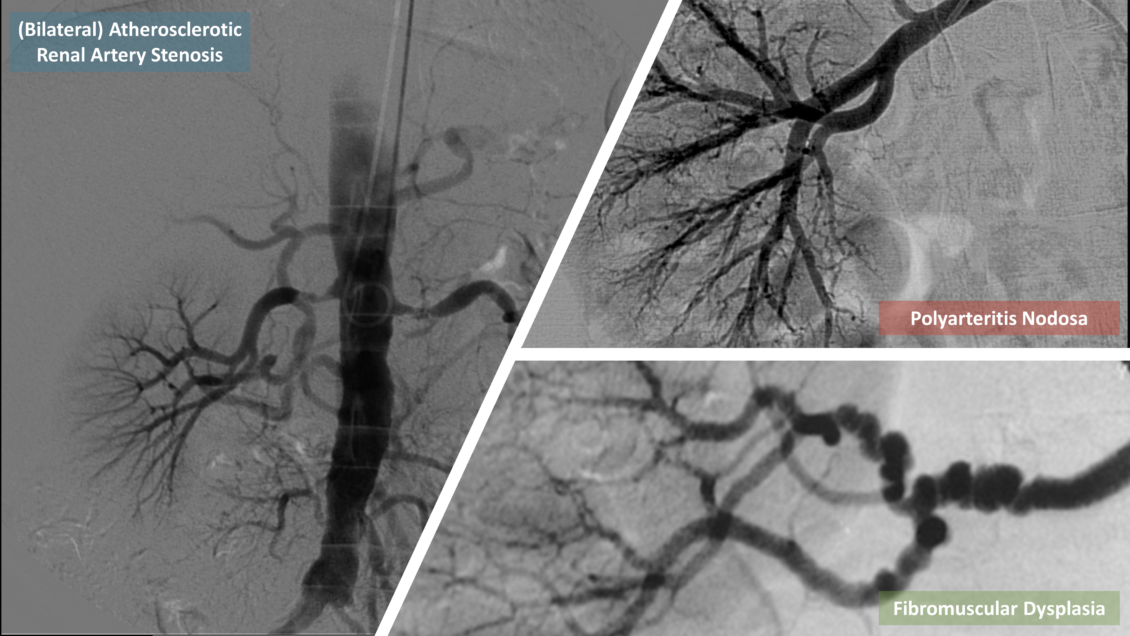 High Yield Guide to Kidney Disorders for Standardized Tests - Renal ...