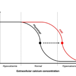 Differentiating Familial Hypocalciuric Hypercalcemia from Primary ...